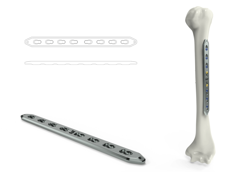 Placas Para la Diáfisis del Húmero – TST