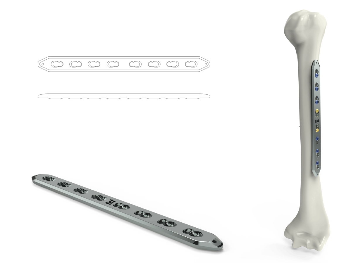 Placas Para la Diáfisis del Húmero – TST