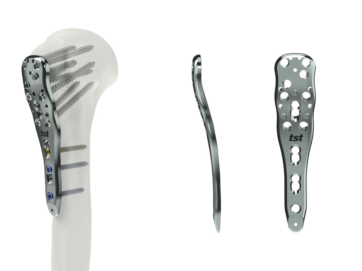 Proximal Humerus Locking Plates – TST