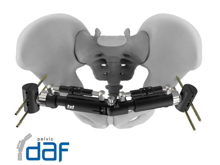 Pelvic Fixator – T Clamp – TST