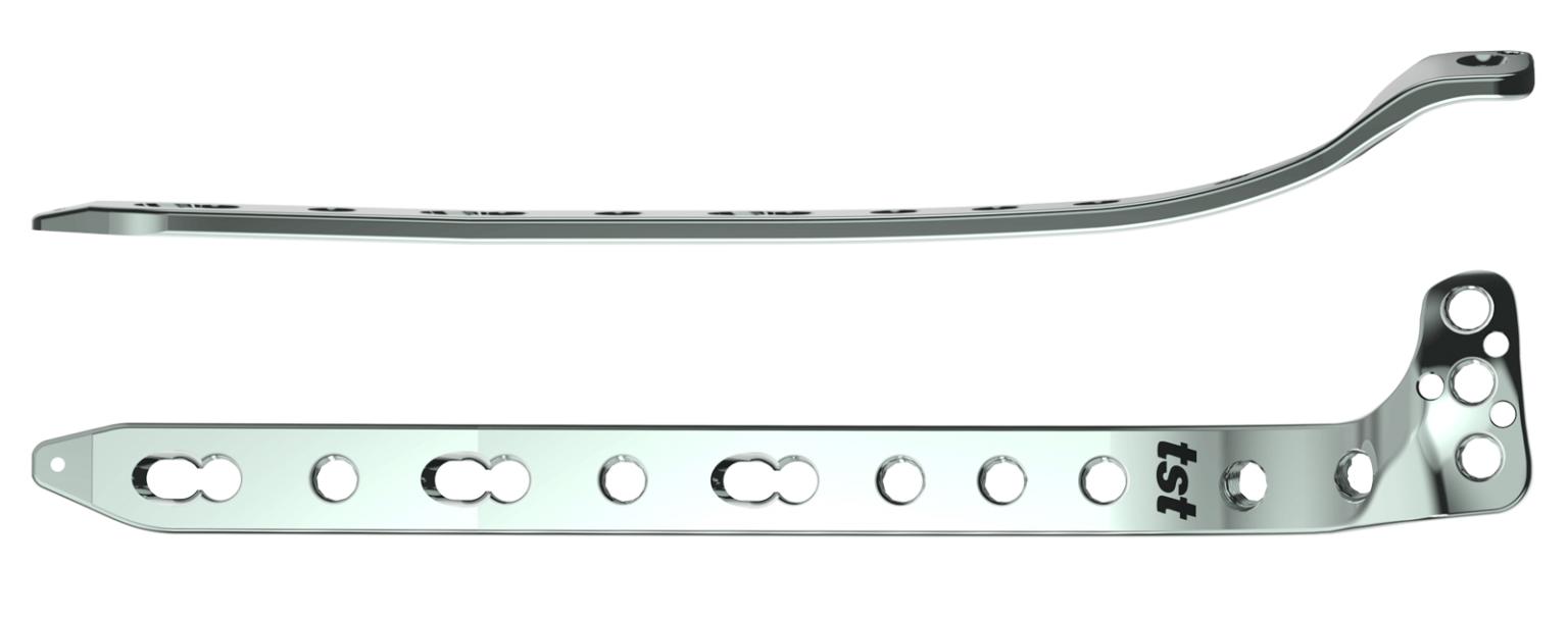 MISS Proximal Tibia Lateral Plates – TST