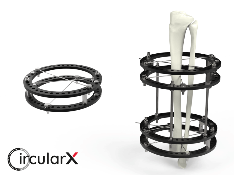 Circular Fixator – TST