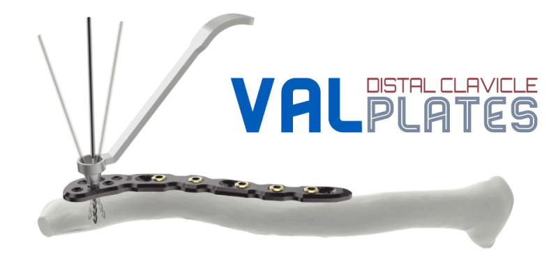 TST – Orthopedic Implants