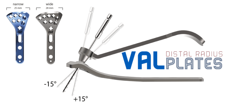 TST – Orthopedic Implants