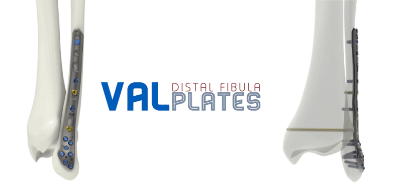 TST – Orthopedic Implants