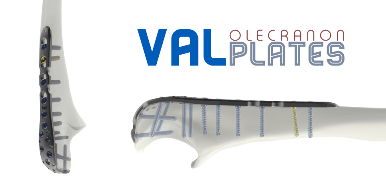 TST – Orthopedic Implants